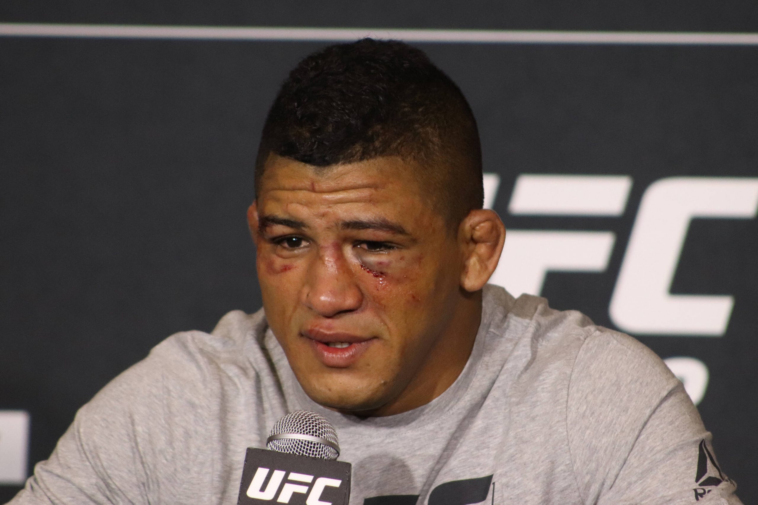 Gilbert Burns set his sights on a fight with Neil Magny