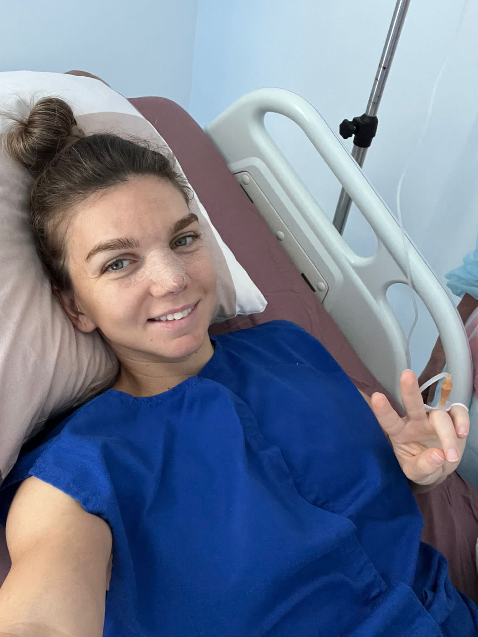 Simona Halep nose job - Everything you need to know about the former ...